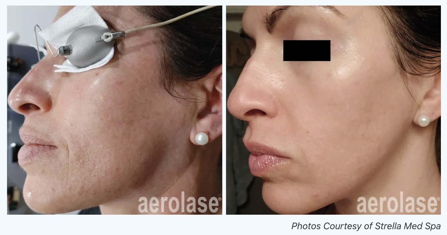 Reverse – SENZU BEAN